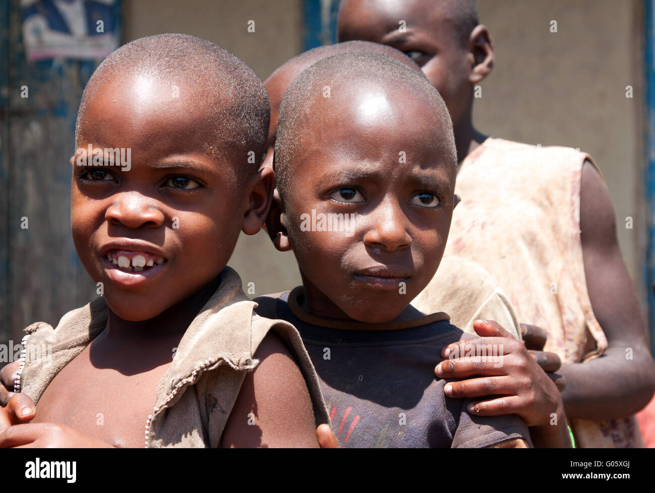Bloated Stomach African Children