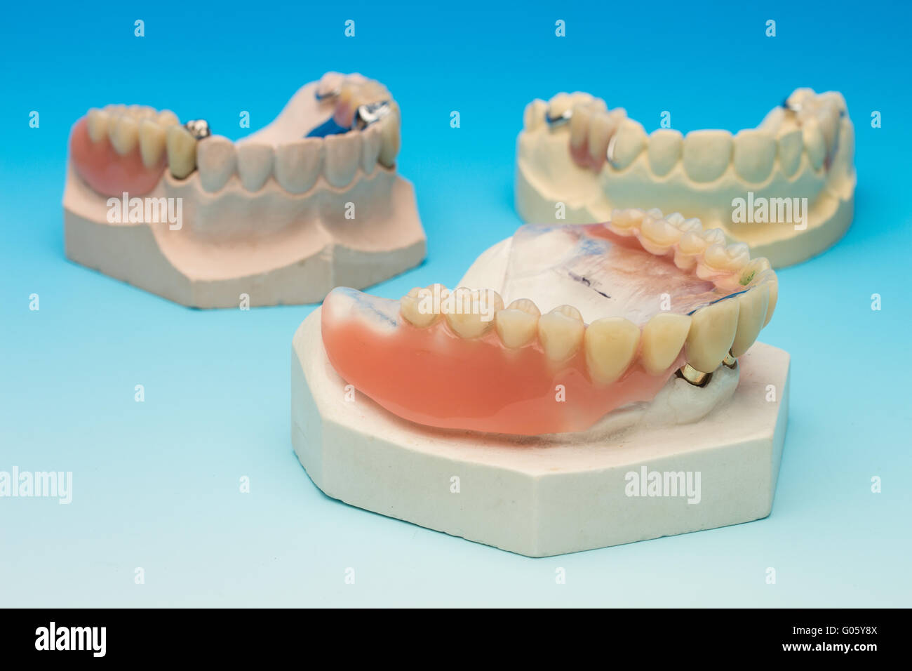 Zahnprothese hi-res stock photography and images - Alamy