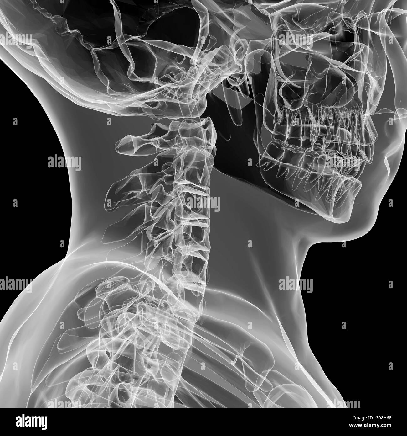 X-ray view of human cervical spine Stock Photo - Alamy