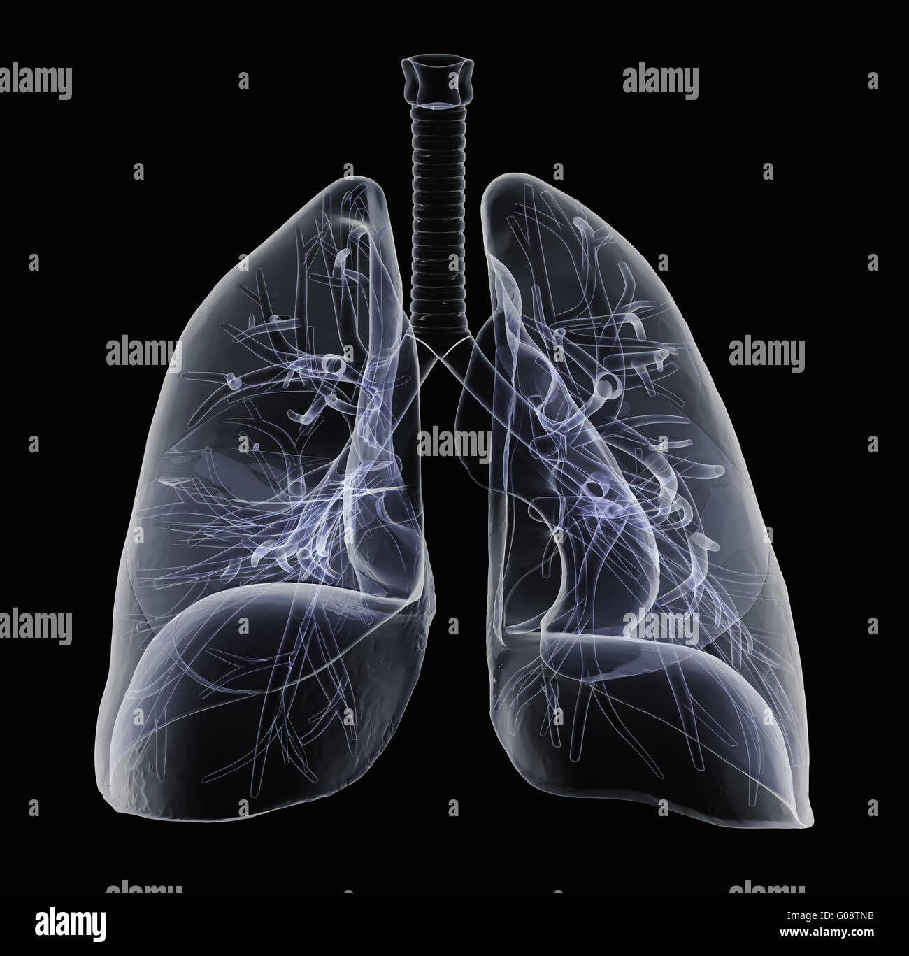 X-Ray of human Lungs Stock Photo - Alamy