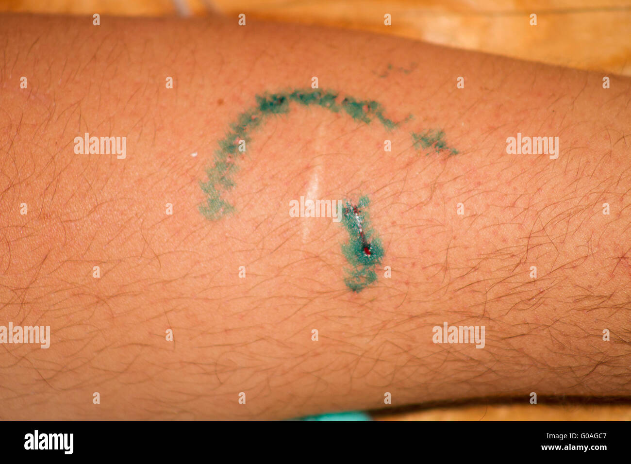 The gash from the bite dogs treated with brilliant Stock Photo - Alamy