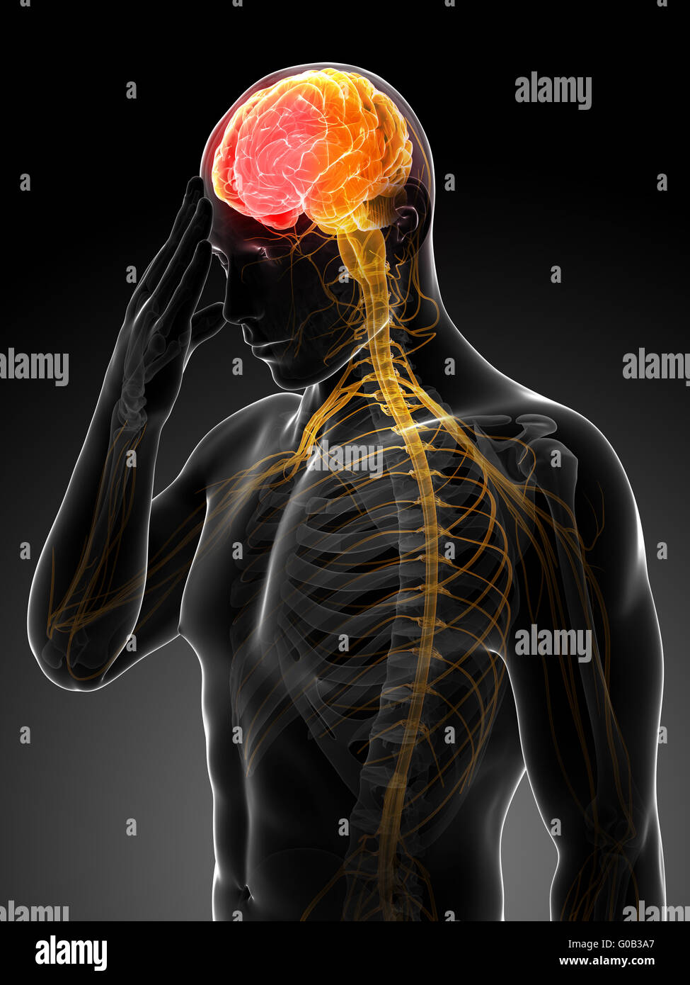 3d rendered conceptual illustration of head pain Stock Photo - Alamy