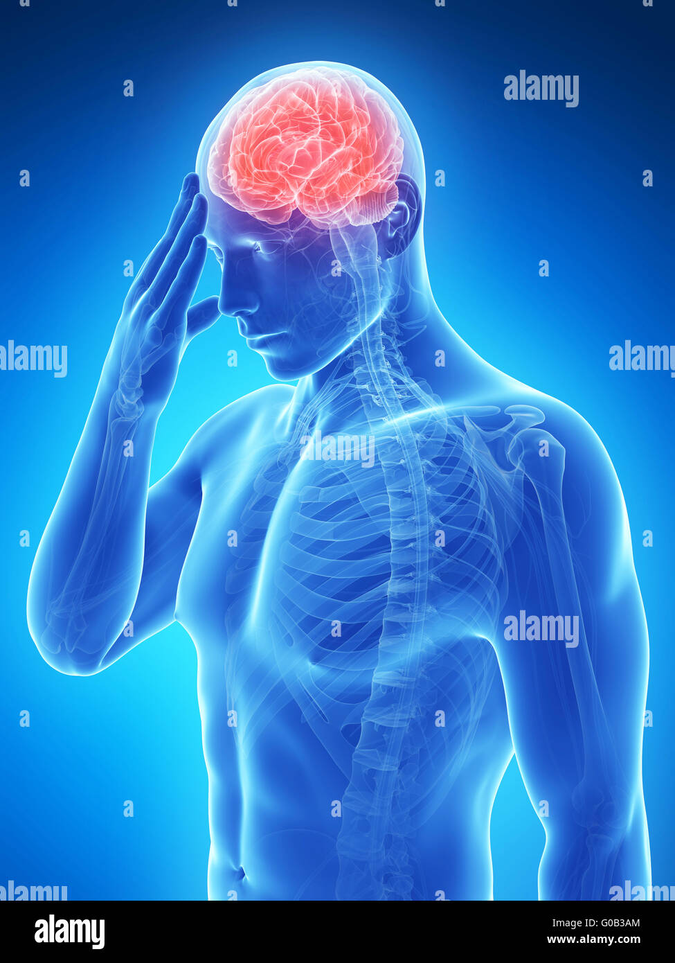 3d rendered conceptual illustration of head pain Stock Photo - Alamy