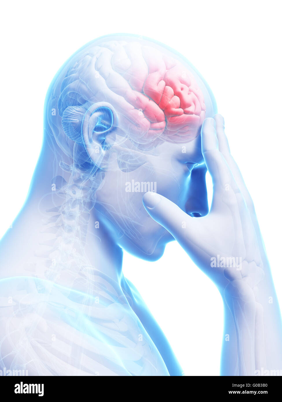 3d rendered conceptual illustration of head pain Stock Photo - Alamy