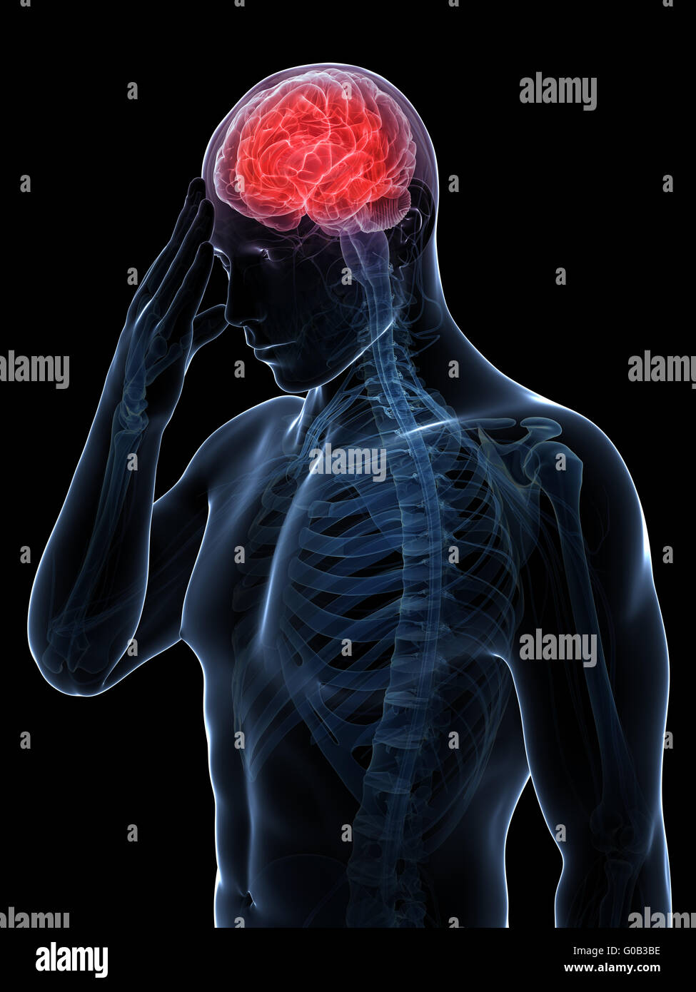 3d rendered conceptual illustration of head pain Stock Photo - Alamy