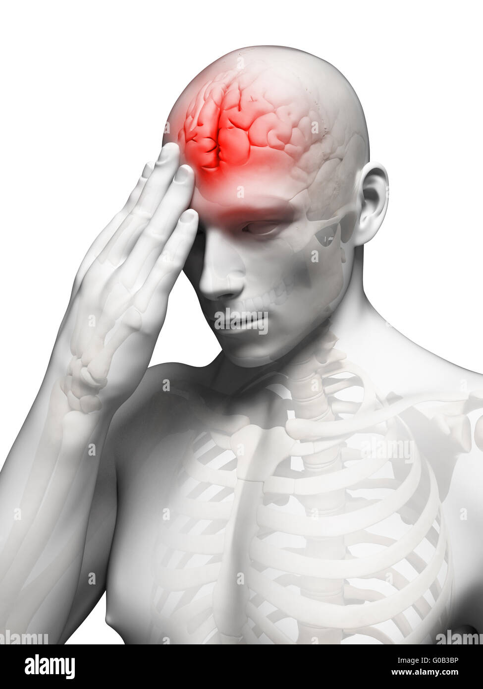 3d rendered conceptual illustration of head pain Stock Photo - Alamy