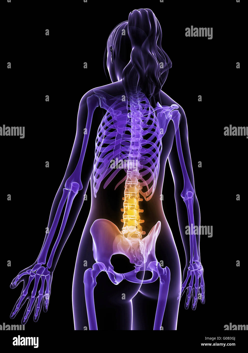 3d rendered illustration of a female having backache Stock Photo - Alamy