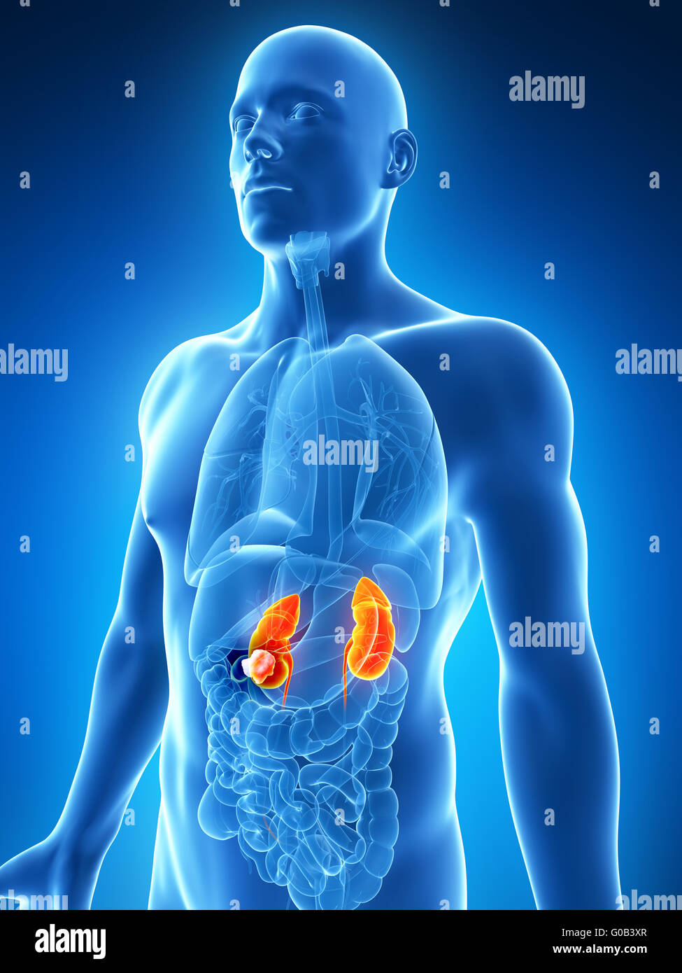 3d rendered illustration of the male kidneys - cancer Stock Photo - Alamy