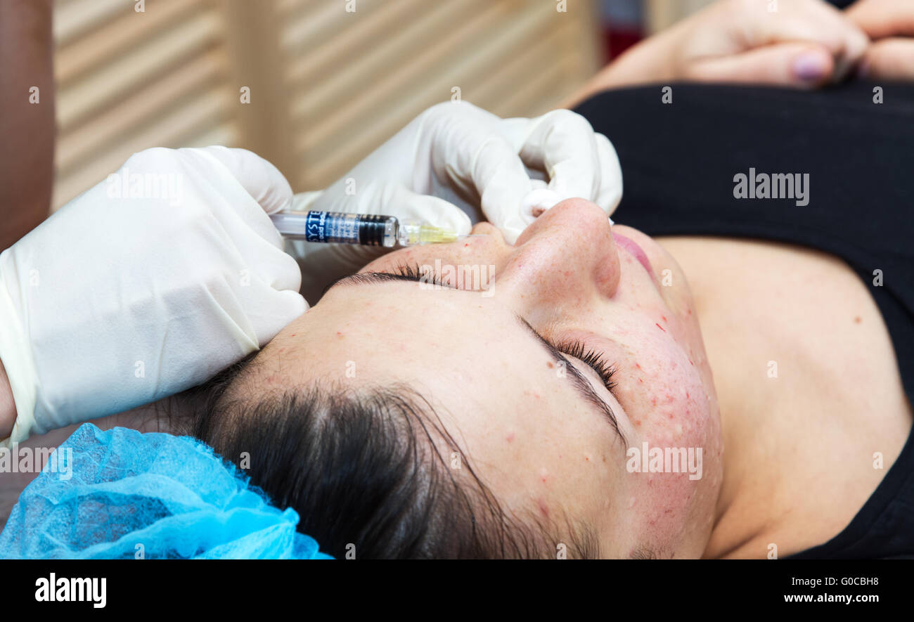 Hyaluronan hi-res stock photography and images - Alamy