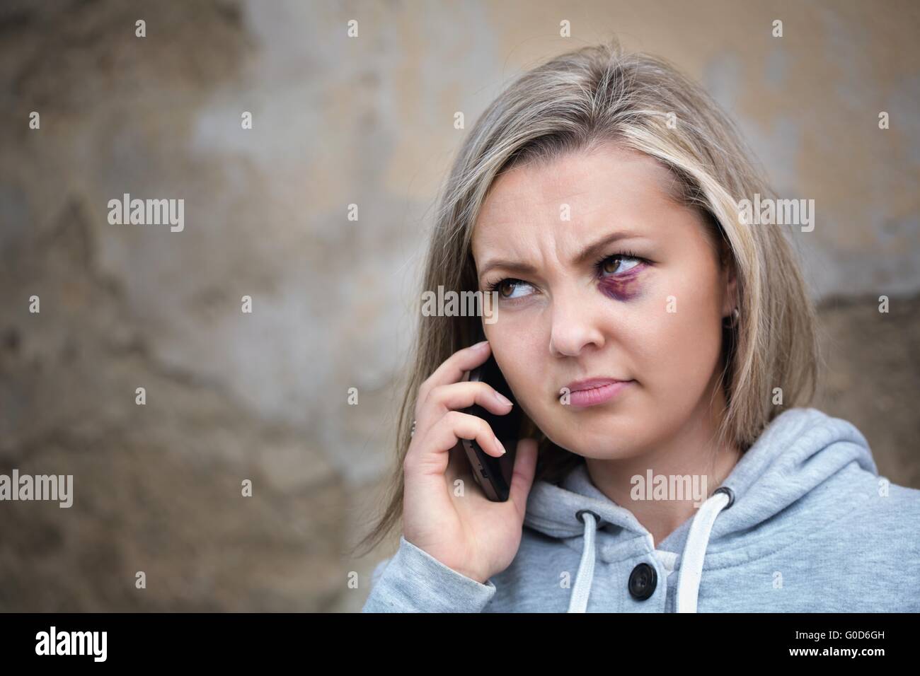 Scared woman with bruise on face calling to get help Stock Photo - Alamy