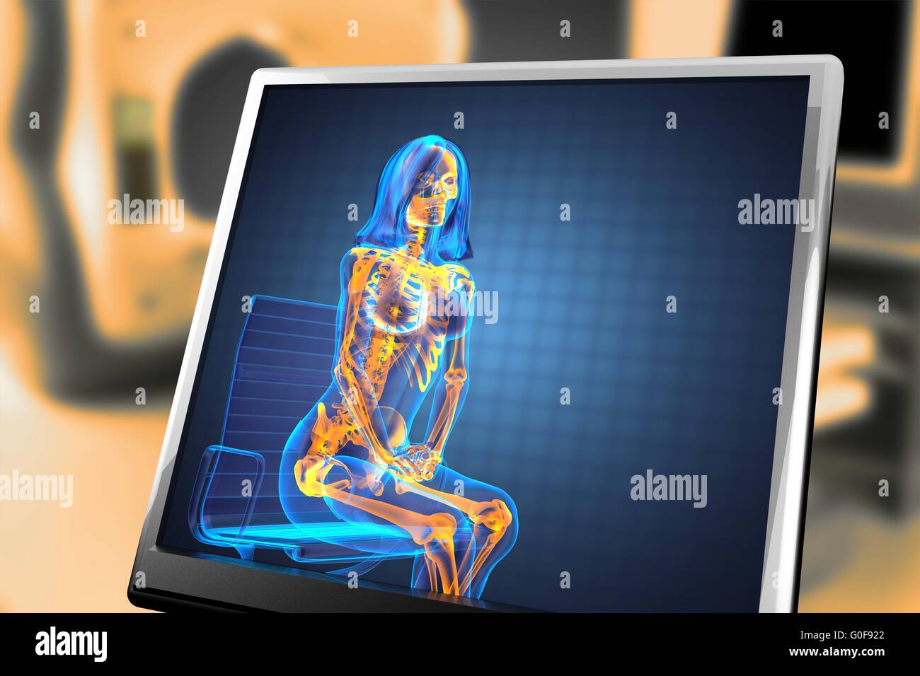 cute woman radiography Stock Photo - Alamy