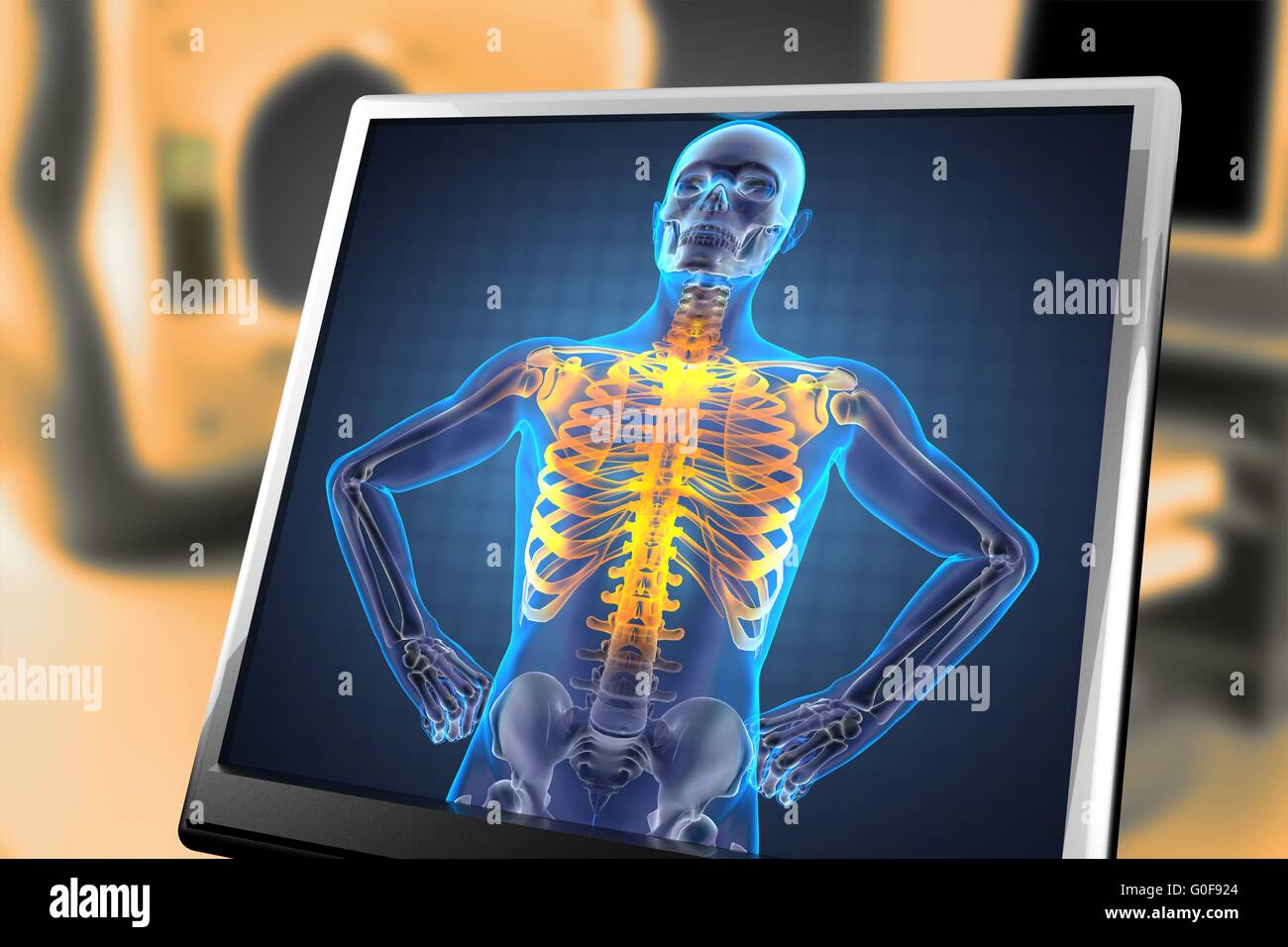 human radiography scan Stock Photo - Alamy