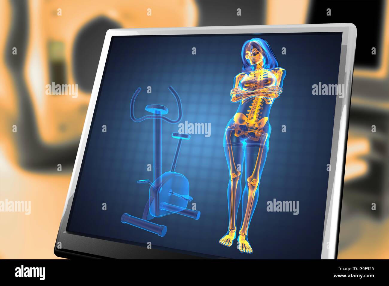 woman radiography scan in gym room Stock Photo - Alamy