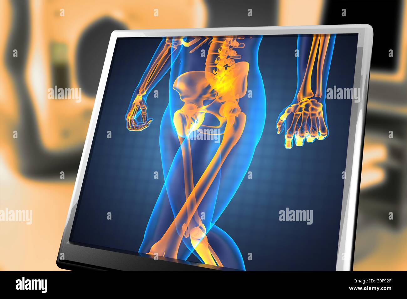 human radiography scan Stock Photo - Alamy