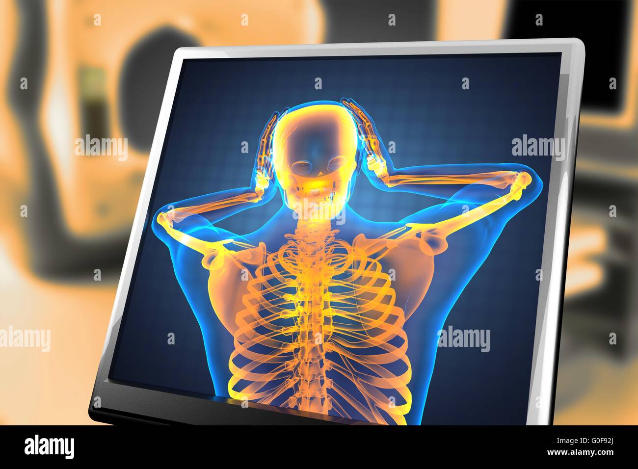 human radiography scan Stock Photo - Alamy