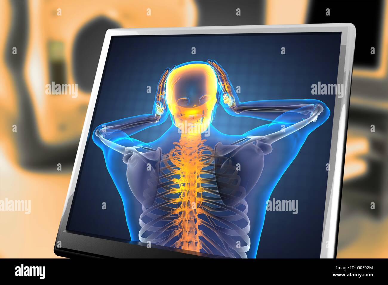 human radiography scan Stock Photo - Alamy