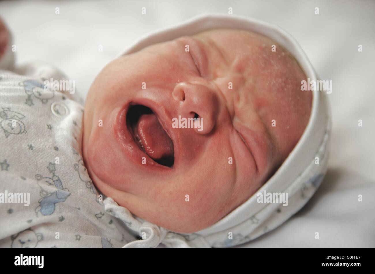 Cradle cap baby hi-res stock photography and images - Alamy