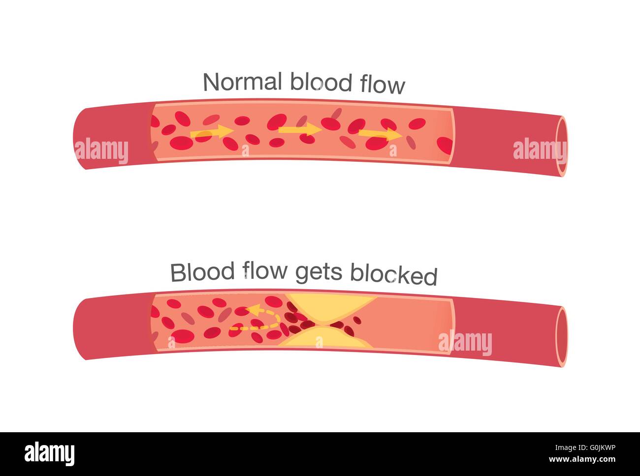 Normal Flow Of Blood Written ISMRM2021 005662_Fig5.png