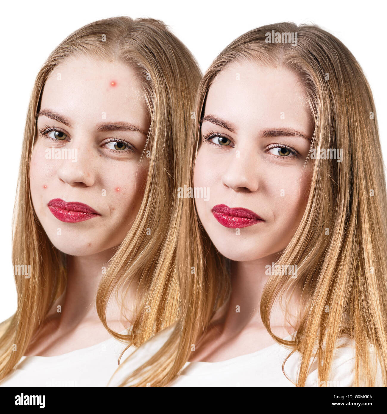 Skin dermatology hi-res stock photography and images - Alamy