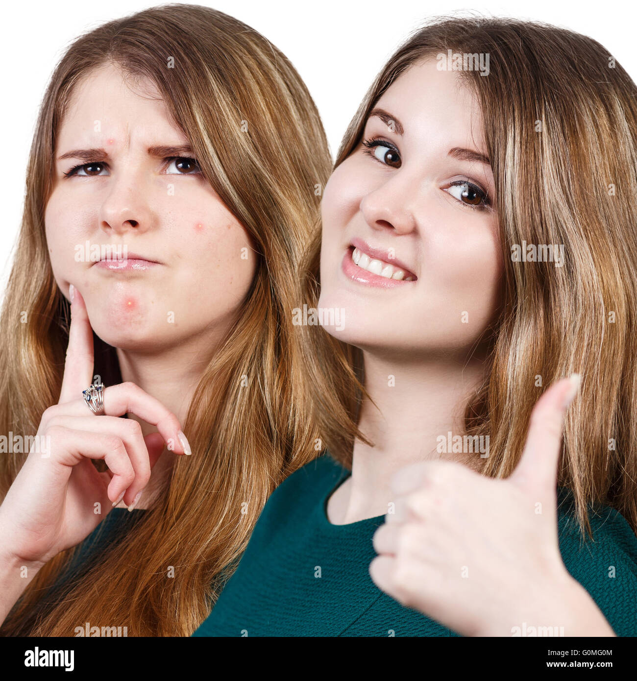 Woman with problem skin on her face Stock Photo - Alamy