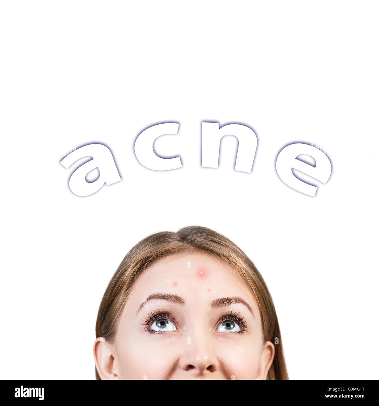 Teen skin problem hi-res stock photography and images - Alamy