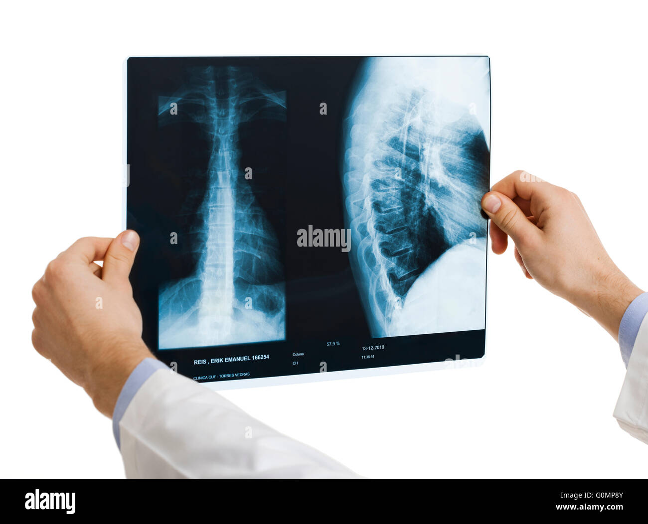 X ray background hi-res stock photography and images - Alamy