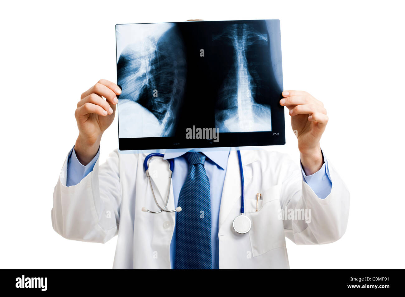 Portrait of a handsome doctor holding a RX, isolated over a white ...