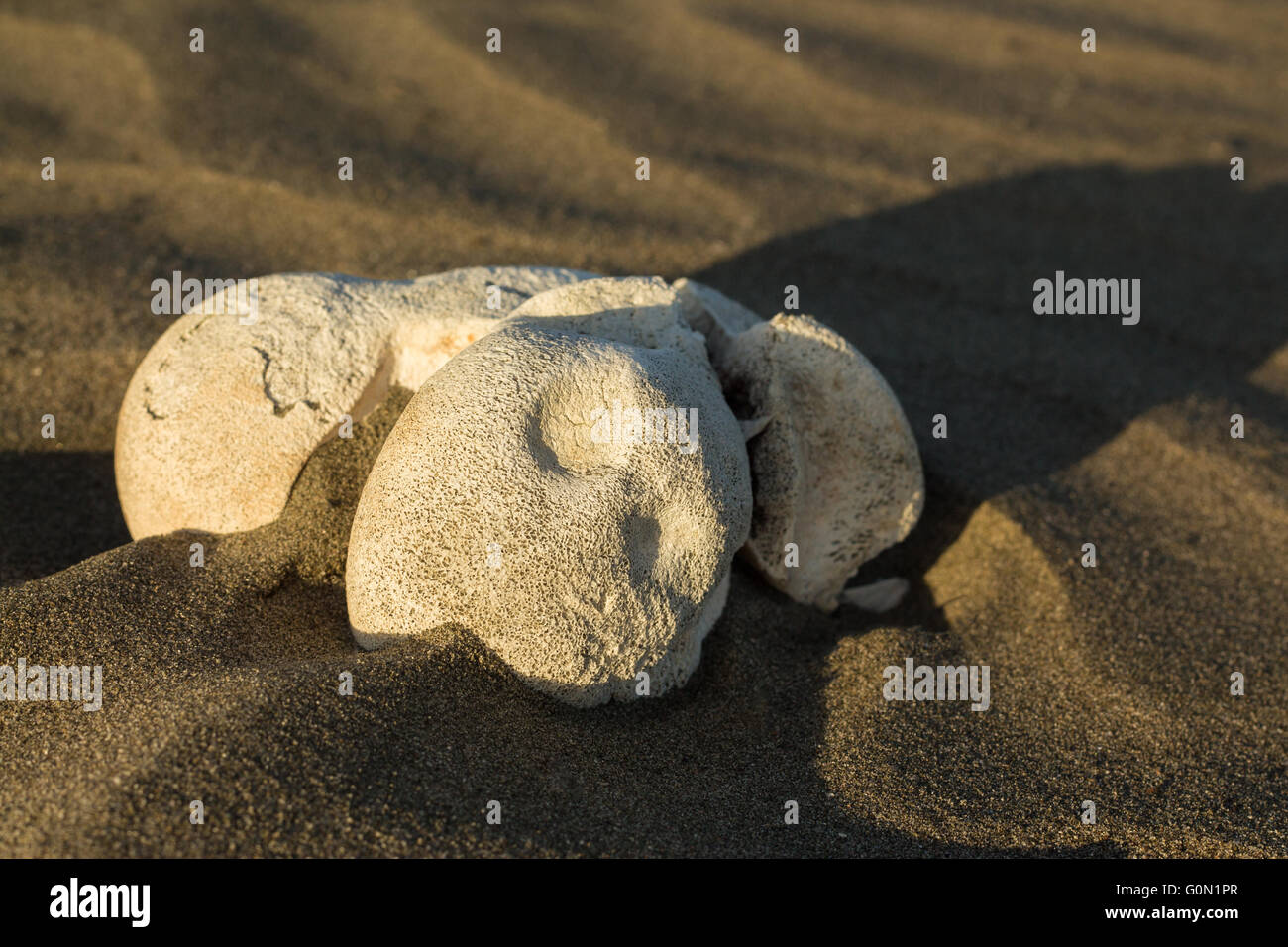 Bone erosion hi-res stock photography and images - Alamy