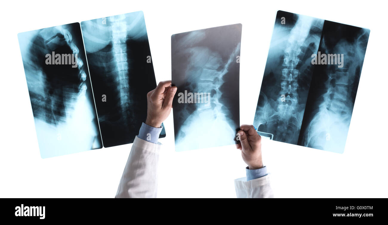 Radiologist checking an x-ray image on a view light box, unrecognizable ...