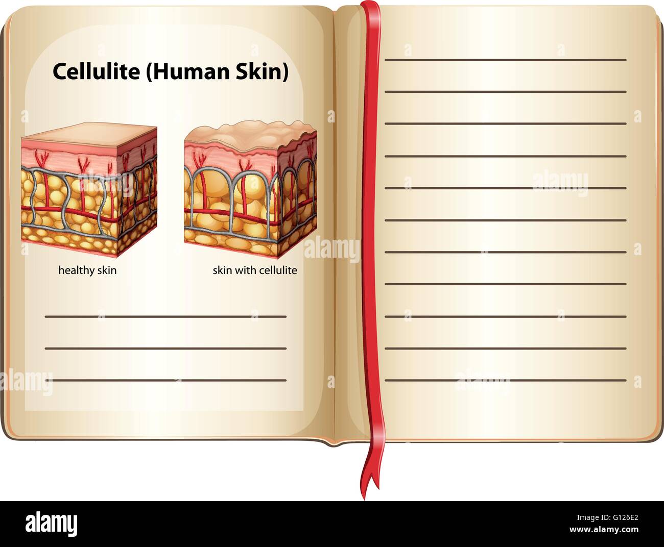 Cellulite drawing hi-res stock photography and images - Alamy