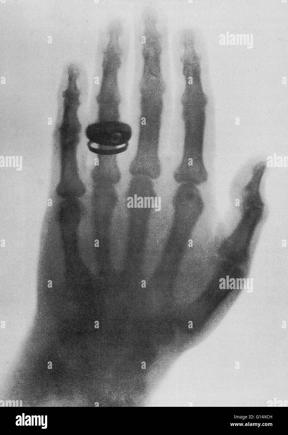Conrad roentgen x ray Black and White Stock Photos & Images - Alamy