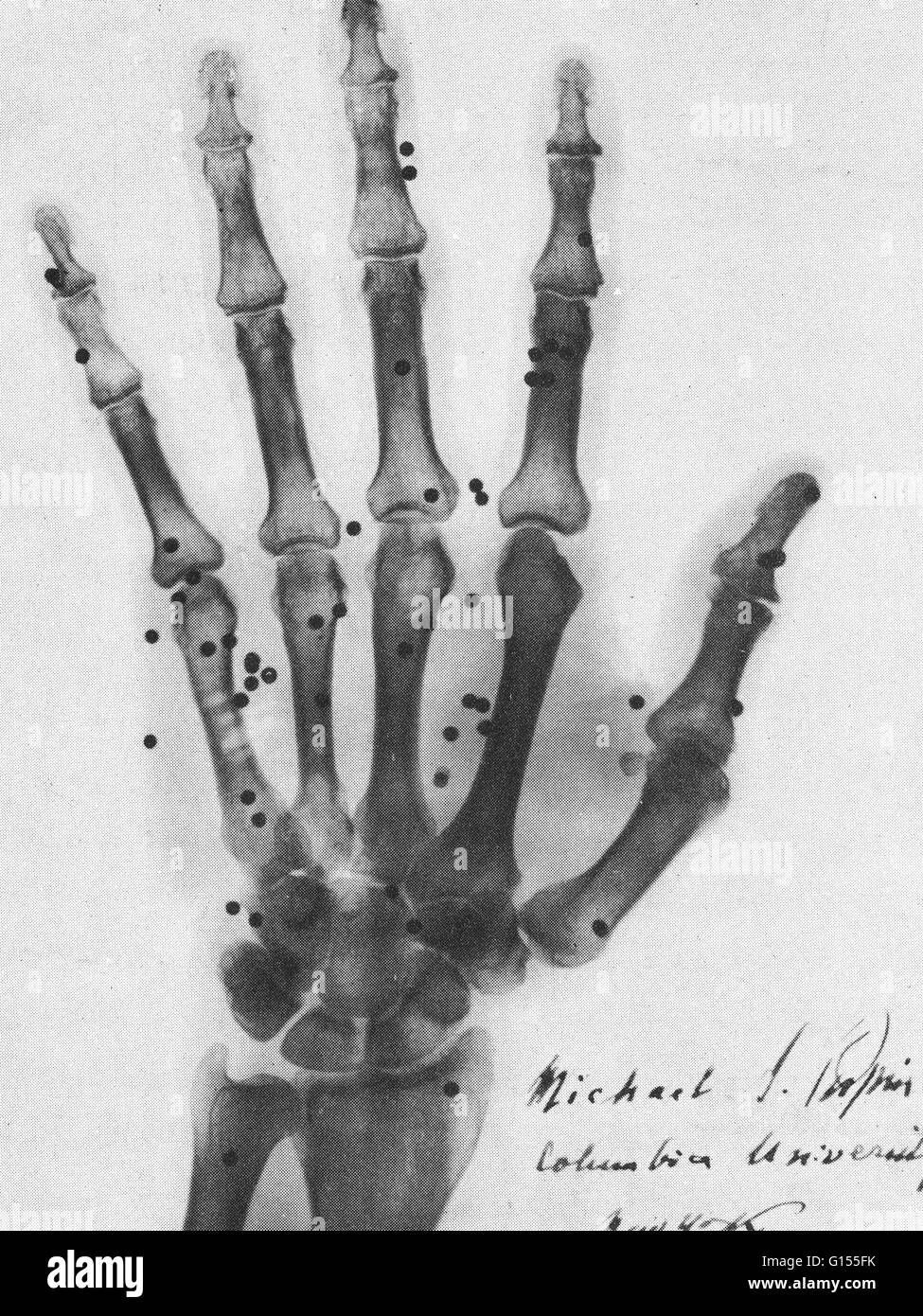 First x ray hand hi-res stock photography and images - Alamy