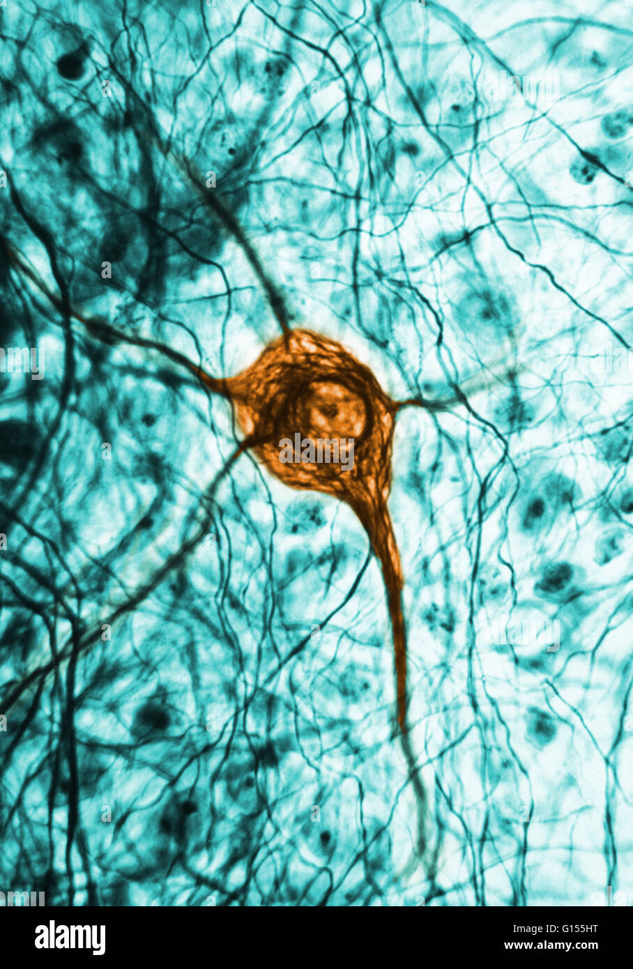 Transmission electron micrograph (TEM) of a mouse neuron and spinal ... Transmission electron micrograph (TEM) of a mouse neuron and spinal ...