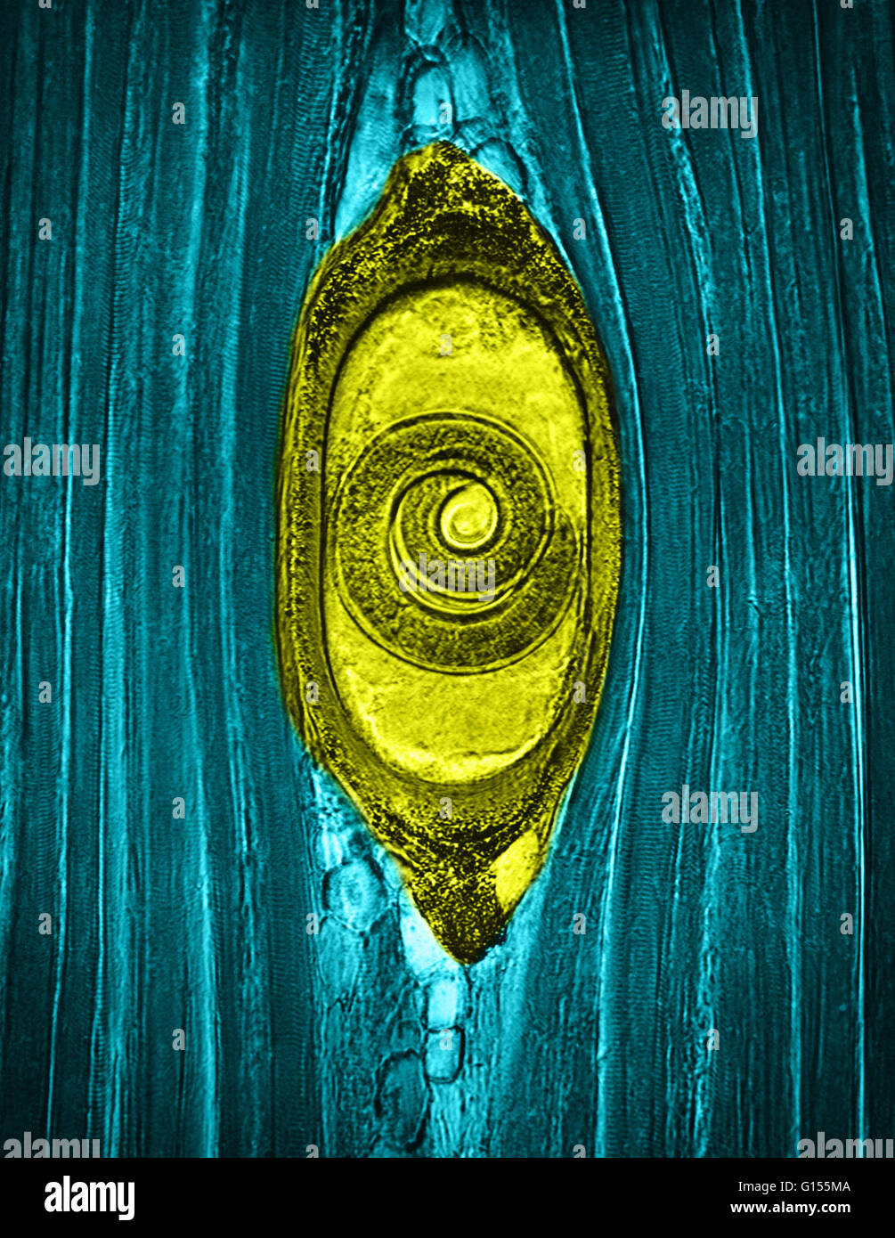 Light micrograph of muscle with encysted Trichinella spiralis (green ...