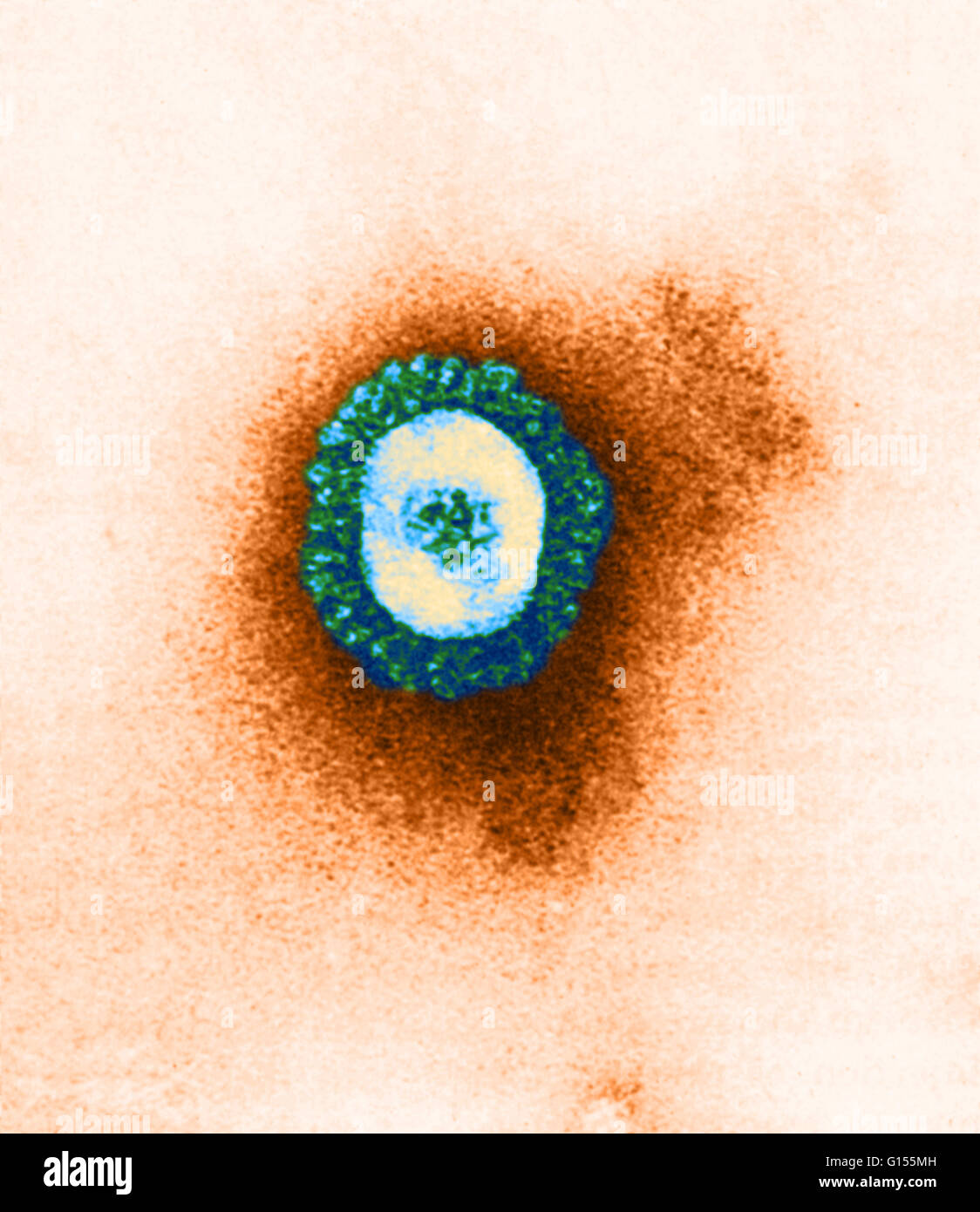 Color enhanced transmission electron micrograph (TEM) of a coronavirus ...