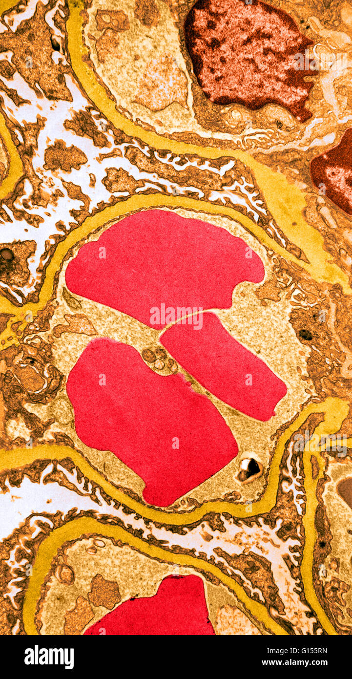 Color enhanced transmission electron micrograph of several red cells in ...