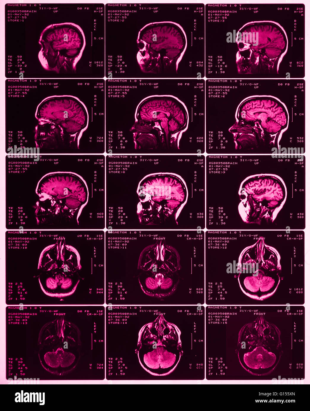 Color enhanced sheet of MRI scans showing showing normal anatomy of the ...