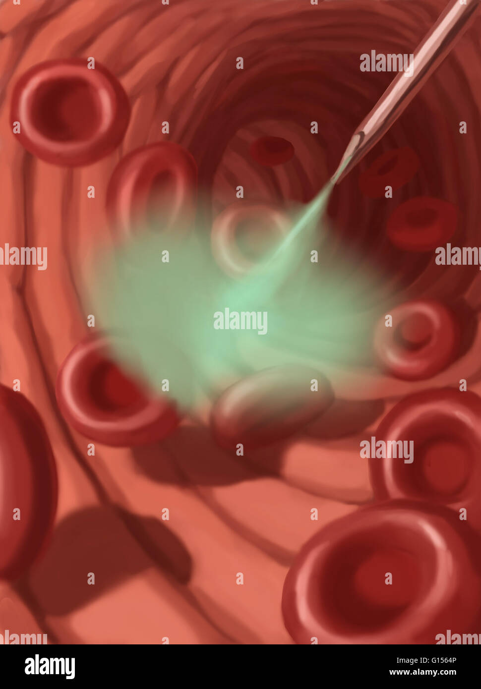 Illustration of a vaccine being injected into a blood vessel Stock ...