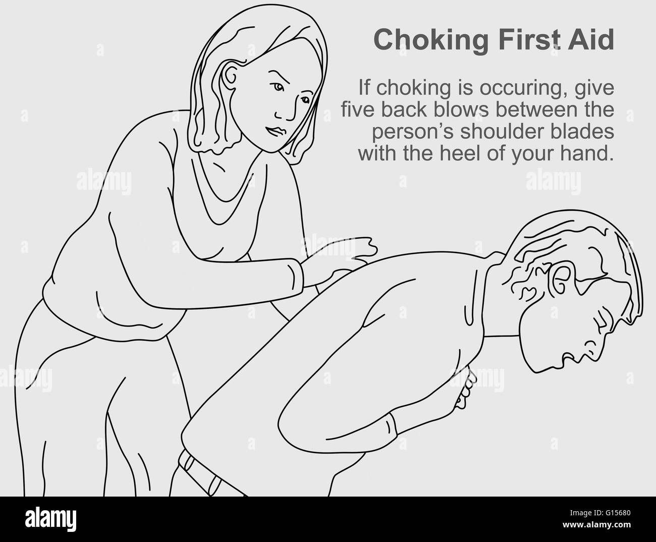 A first aid illustration on how to help a person who is choking Stock ...