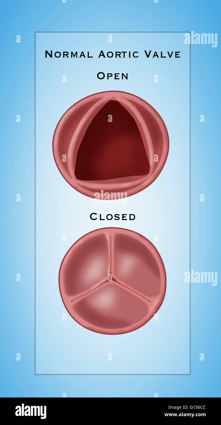 Illustration of a normal aortic valve. At the top is a close up of a ...