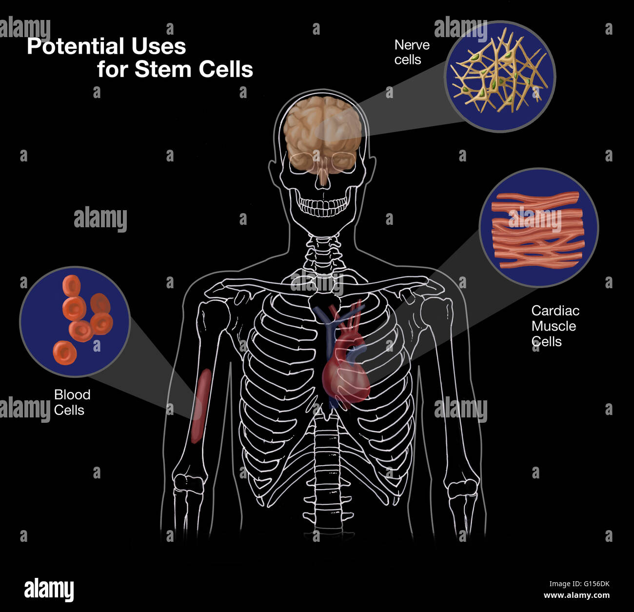 Diagram showing the potential uses for stem cells to replace or ...