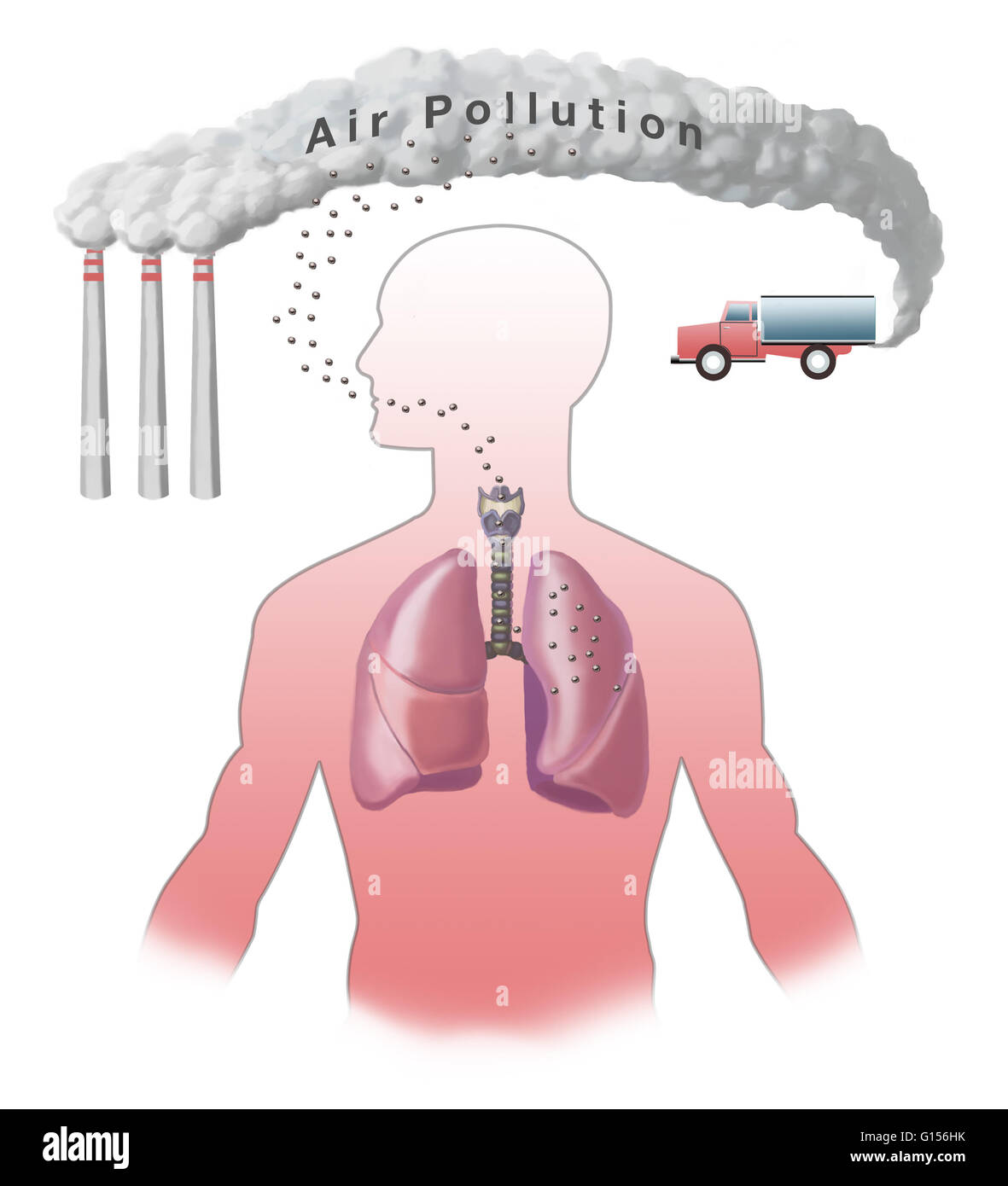 Illustration showing air pollution affecting a person's lungs. Air ...