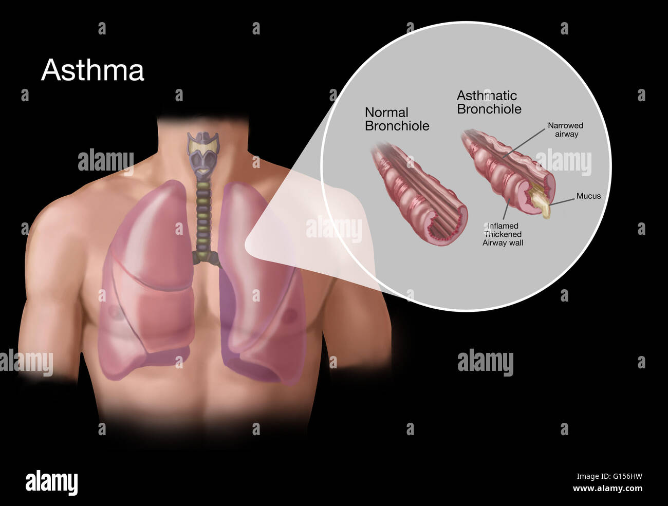 Respiratory Mucus Artwork High Resolution Stock Photography and Images ...