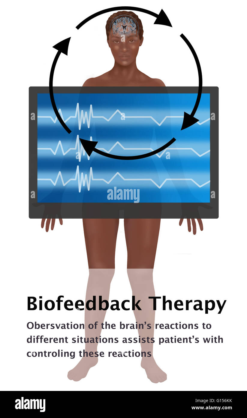 Illustration of biofeedback therapy. Biofeedback is sometimes used to ...