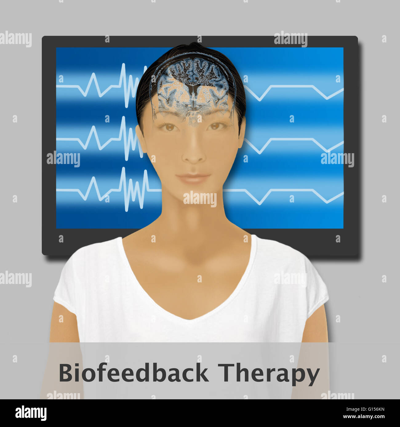 Illustration of biofeedback therapy. Biofeedback is sometimes used to ...