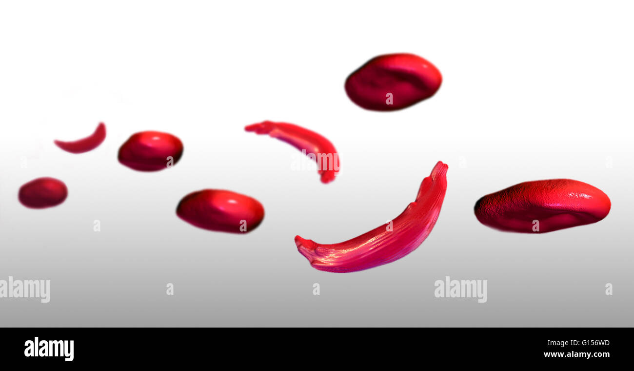 Illustration of Sickle Cells Stock Photo - Alamy