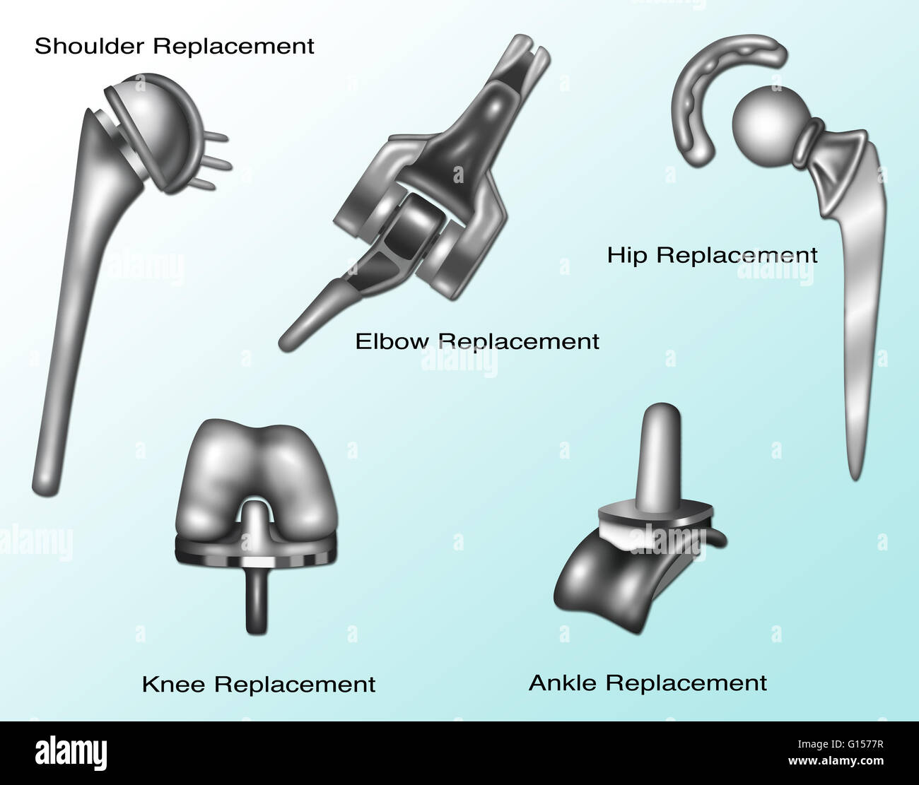 Shoulder joint drawing hi-res stock photography and images - Alamy