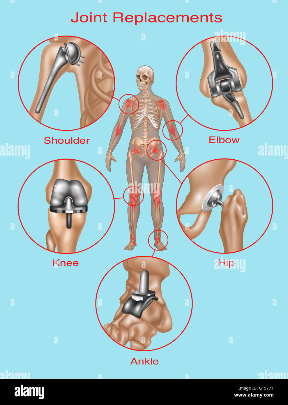 Shoulder joint drawing hi-res stock photography and images - Alamy