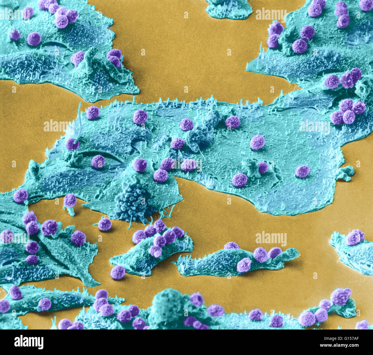 Scanning Electron Micrograph (SEM) showing immune cells (small ... Scanning Electron Micrograph (SEM) showing immune cells (small ...