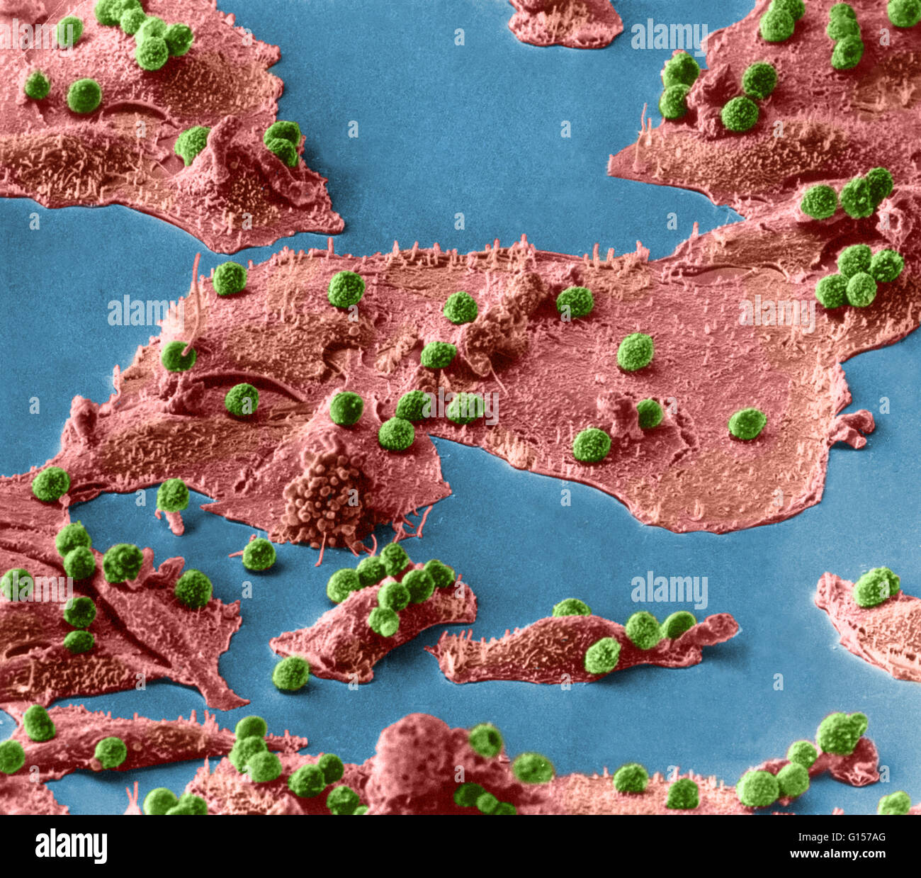 Cancer cells green hi-res stock photography and images - Alamy